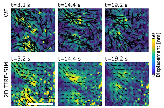 李栋合作团队开发出新型生物力显微镜